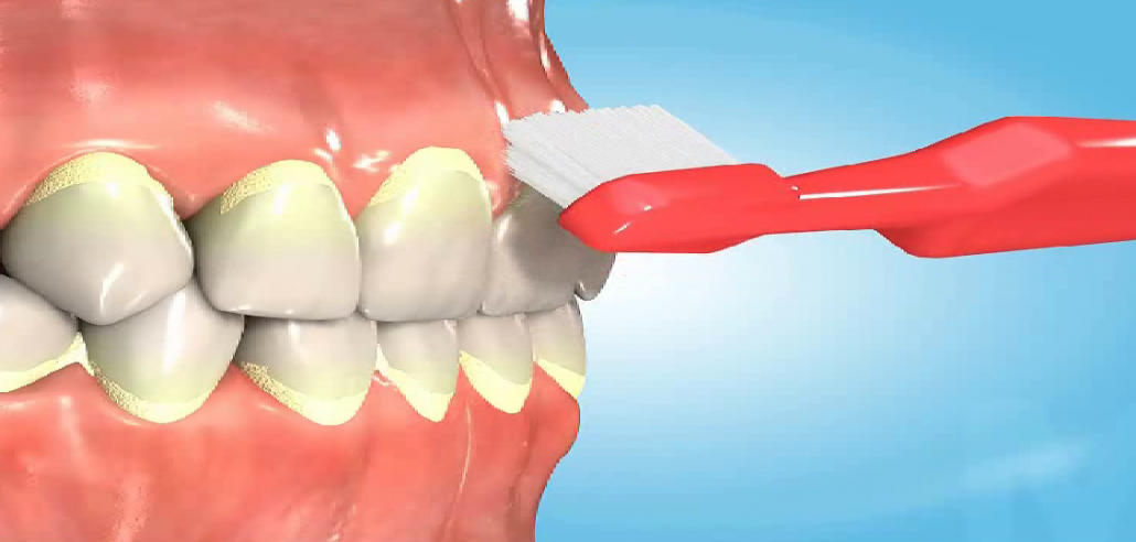 Preventative Care & Visiting the Hygienist | Family Dental Care